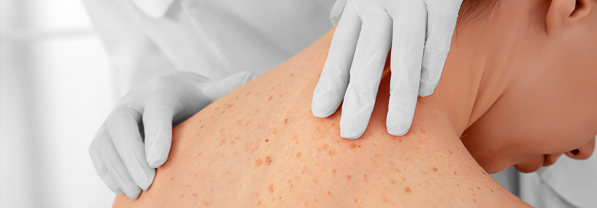 Dermatología Clínica y Estética | Clínica La Parva